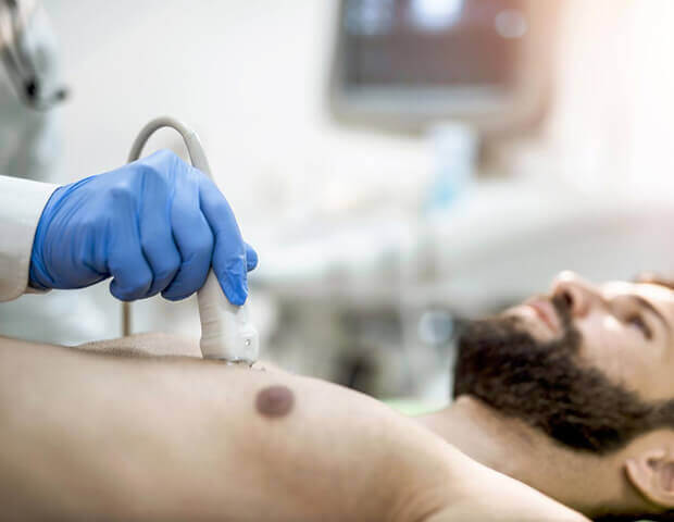 Exercise Stress Echocardiogram in North Atlanta